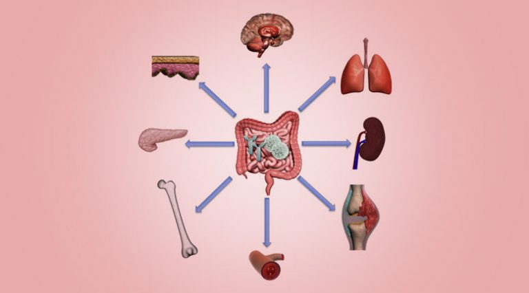 Harmless Bacteria Cause Autoimmune Disease – QED Bioscience Inc