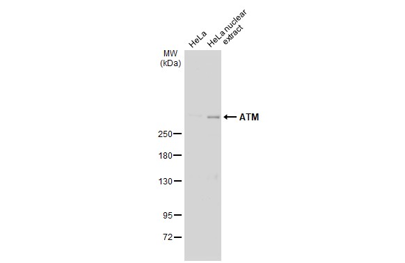 Anti-ATM Antibody – QED Bioscience Inc