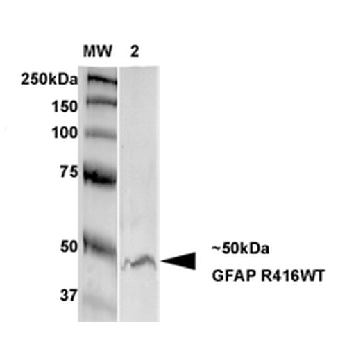 Anti-Glial Fibrillary Acidic Protein (GFAP) Antibody – QED Bioscience Inc