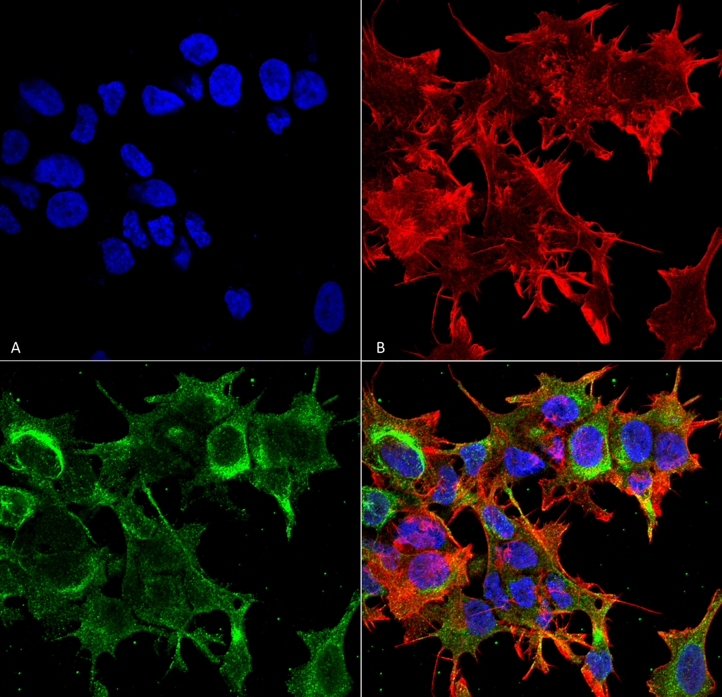 Anti-Glial Fibrillary Acidic Protein (GFAP) Antibody – QED Bioscience Inc