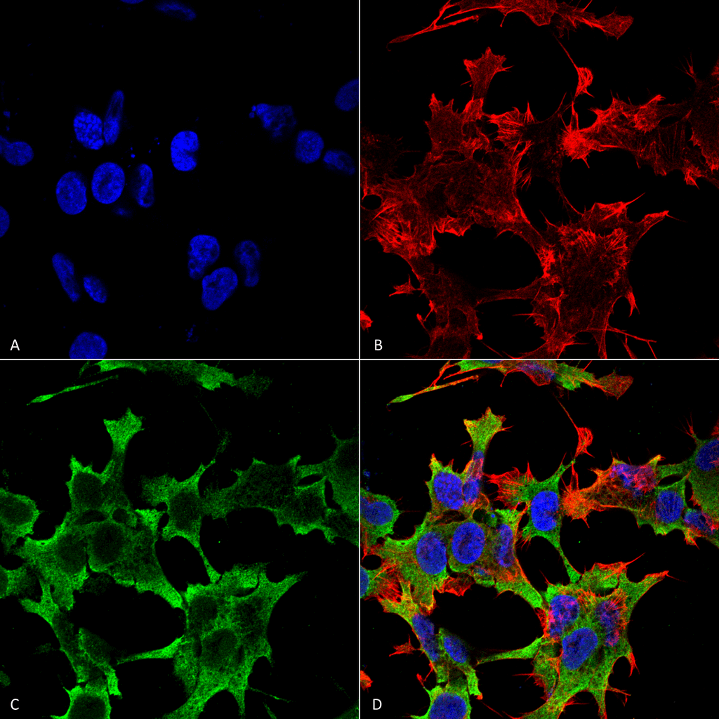 Anti-Protein Tyrosine Phosphatase Receptor F (PTPRF) Antibody – QED ...